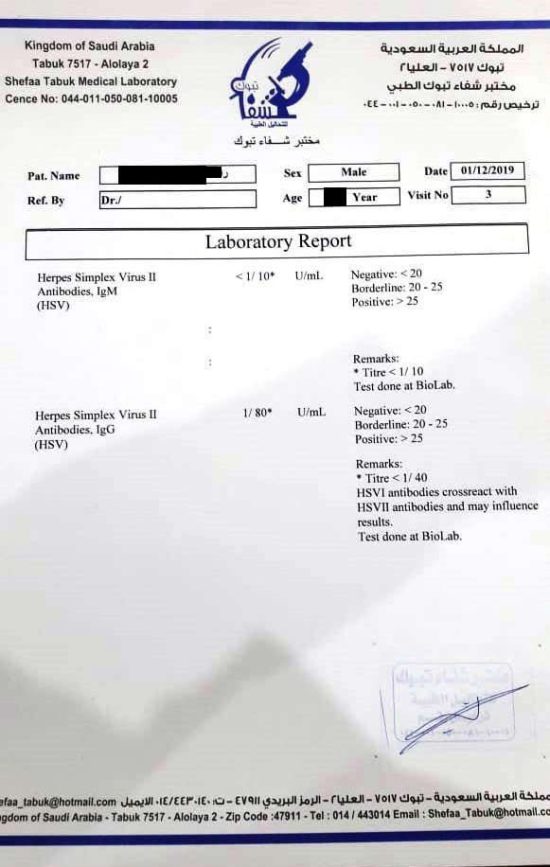 Ras. Manages the Herpes Virus Within a Month - Hekma Center