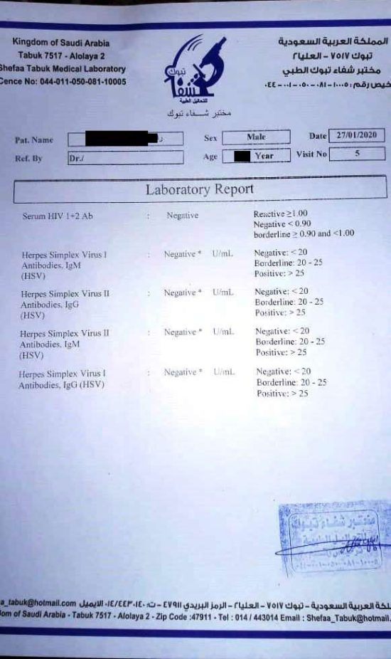 Ras. Manages the Herpes Virus Within a Month - Hekma Center